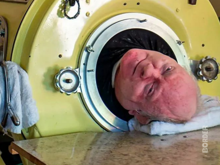 Murió Paul Alexander: el hombre que vivió en un pulmón de acero